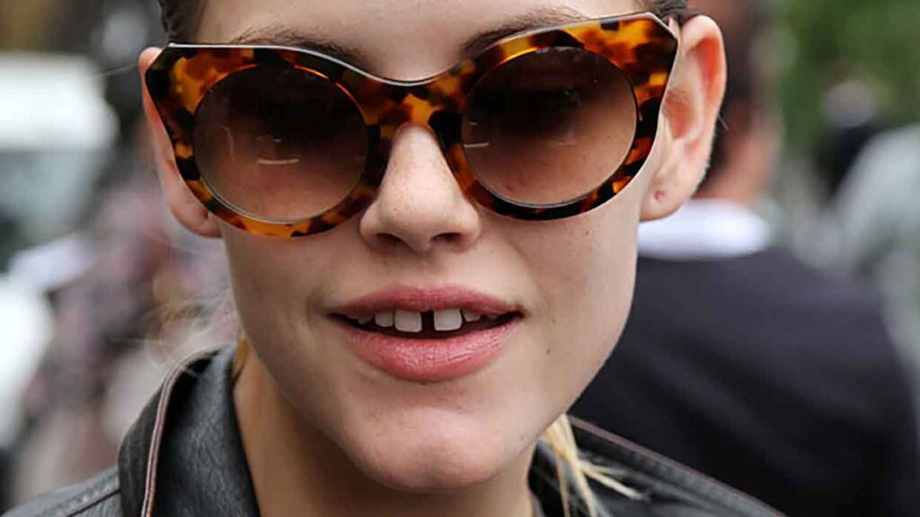 Beauty trend: de kracht van de imperfectie. Spleetje tussen je tanden